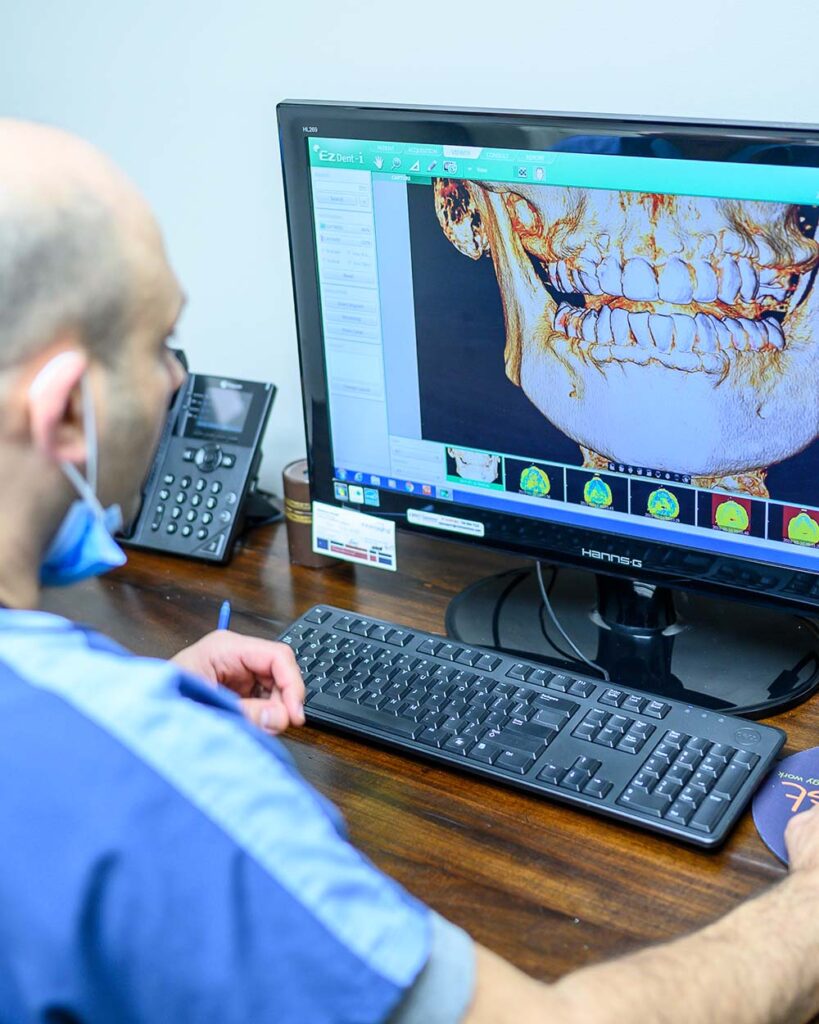 Tooth Extraction at LaGrange Oral Surgery